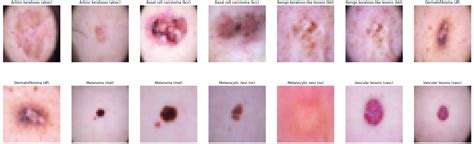 GitHub Rachitjindal Pigmented Skin Lesions Classification CNN The Main Objective Is To