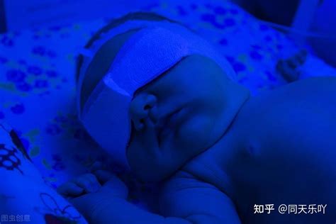新生儿黄疸防治，中医防治越来越受重视！ 知乎