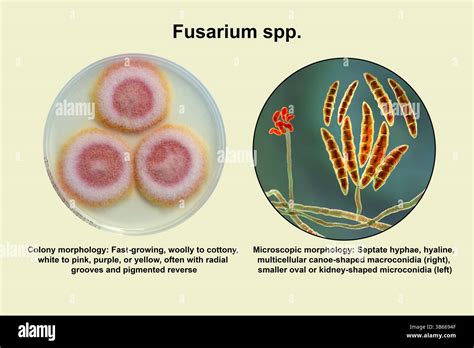 Illustration Of Fusarium Sp Fungi Showing The Microscopic Structure