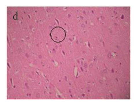 Microstructure Of Brain Tissue Under Light Microscope With 200 ×
