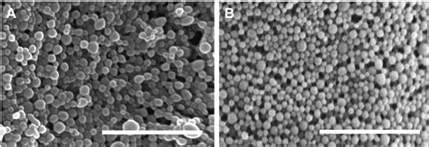 In Vivo And Cellular Trafficking Of Acetalated Dextran Microparticles