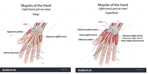 Extensor Assembly And Diagram Of Extensor And Flexor Tendons Of The