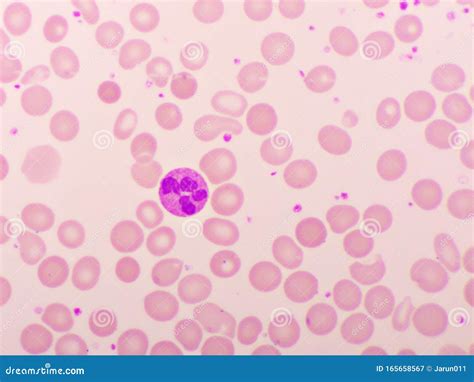Neutrophil With Red Blood Cells Royalty Free Stock Image