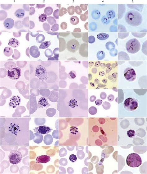 Plasmodium Vivax Trophozoite Morphology