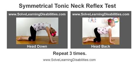 Retained Symmetrical Tonic Neck Reflex Stnr Solve Learning Disabilities