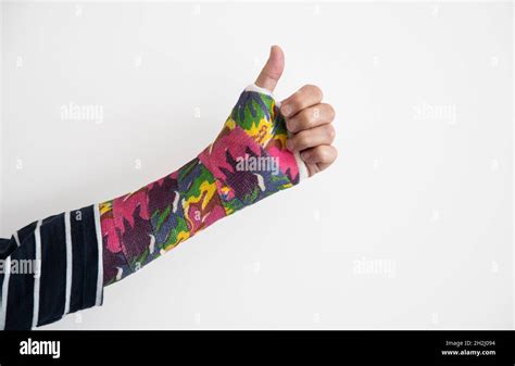 Elbow Cast Colors