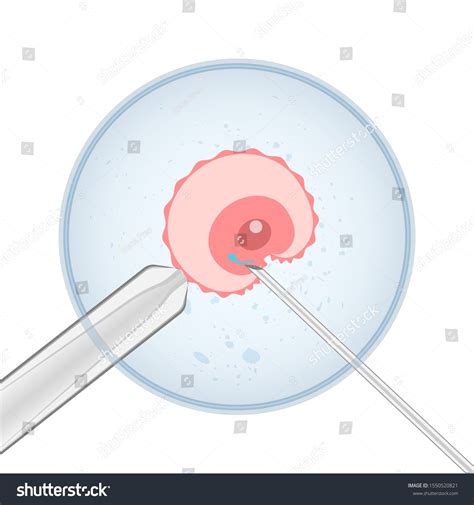 Ovum Sperm On Needle Under Microscope Stock Vector Royalty Free 1550520821 Shutterstock