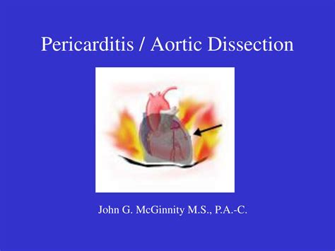 Ppt Pericarditis Aortic Dissection Powerpoint Presentation Free