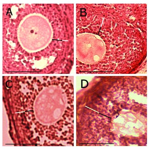 Thickness Of Theca Tc And Granulosa Cell Gc Layers In Control