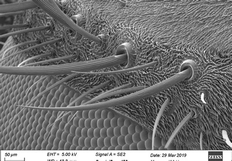 Electron Microscopy University Of Gothenburg