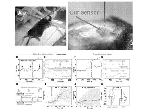 Neurothread Biosignal Monitoring Could Sew Up Neurological Diagnoses Bioworld
