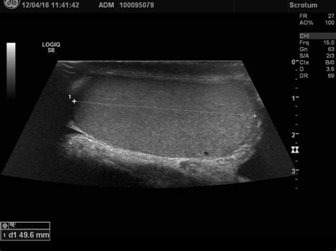 Echographie France Imageries Territoires Structurer Innover Et
