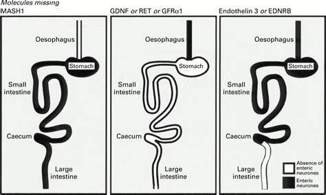 Embryology And Development Of The Enteric Nervous System Gut