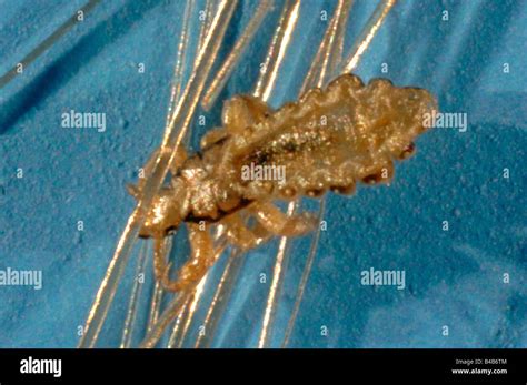 Lice Egg Under A Microscope