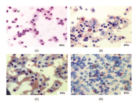 The Infiltration Of Inflammatory Cells In Different Groups A Download Scientific Diagram