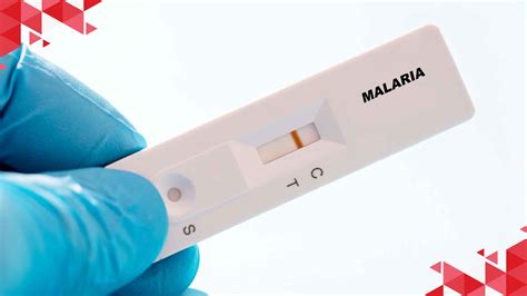 Revolutionizing Malaria Diagnosis From Microscopy To Ai‑driven Rapid