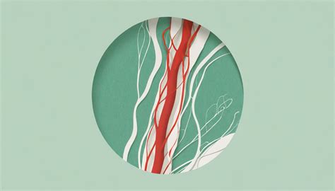 Diagnosing Spinal Arteriovenous Malformation Spinal Avm