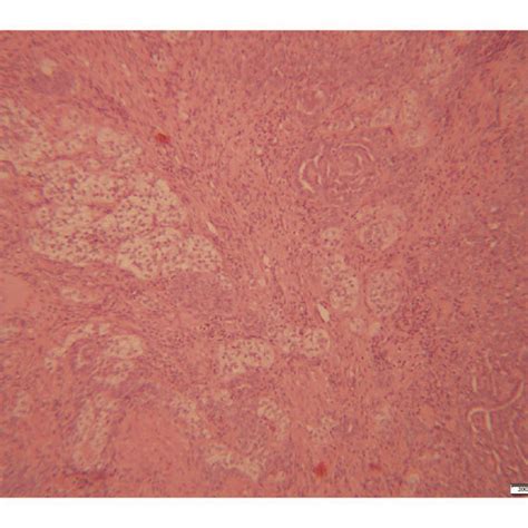 Hande Microscopic Image Of The Polyp Which Was Composed Of Elements