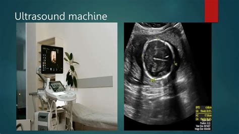 Reproductive System Ppt Pptx Radiographic Pptx