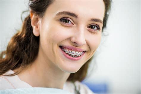 Are Dental Braces Really Helpful For Teeth Somerset Dental
