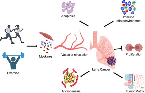 Treatment Of Lung Cancer