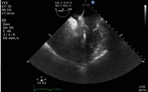 Share Your Cool Tee Echo Cases Student Doctor Network