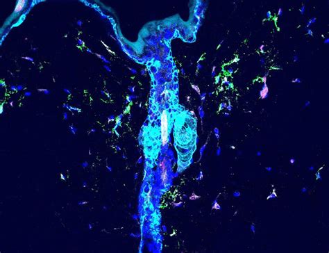 Convergent Evolution Of Monocyte Differentiation In Adult Skin