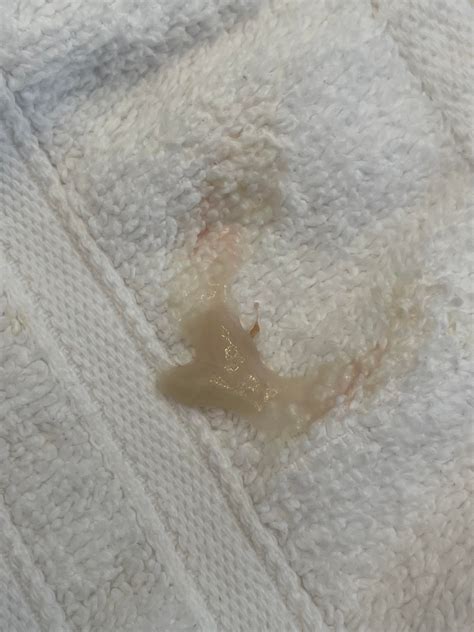 Sinus Pain Starts Around Same Time Everyday Rsinusitis