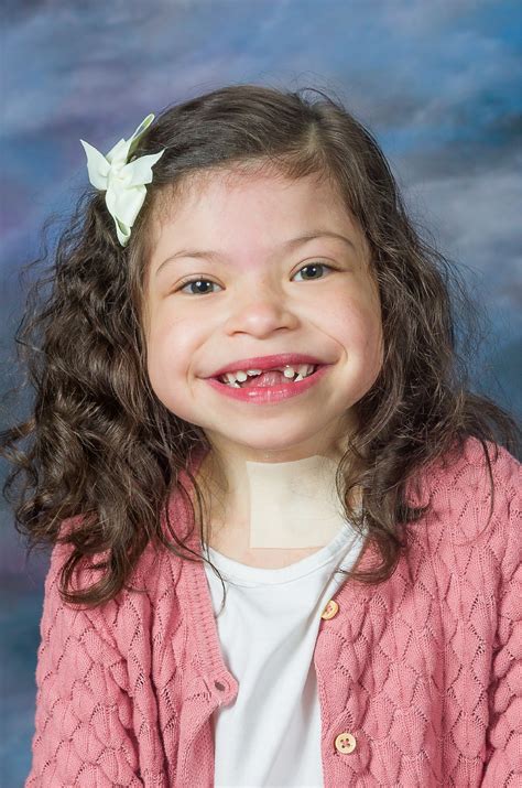 Williams Syndrome Williams Syndrome Association