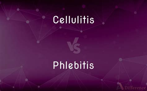 Cellulitis Vs Phlebitis — Whats The Difference