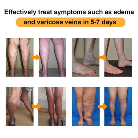 Aqa™ Joint And Bone Therapy Turmeric Ginger Treatment Spray