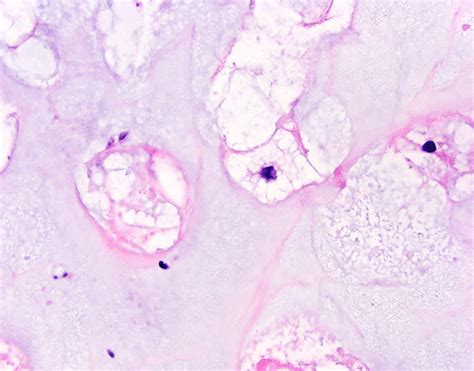 Neuropathology Blog Etymology Of The Word Physaliferous