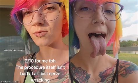 Woman Who Underwent Split Tongue Procedure Reveals It Was Worth It