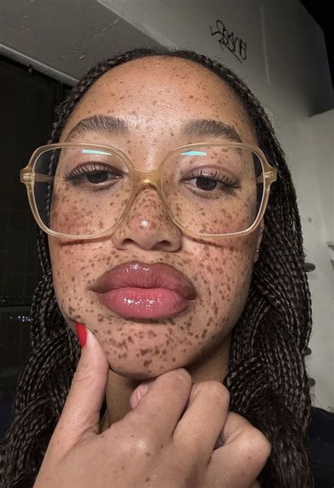 Freckles On Lips Glasses And Freckles Face Inspo Pretty Face