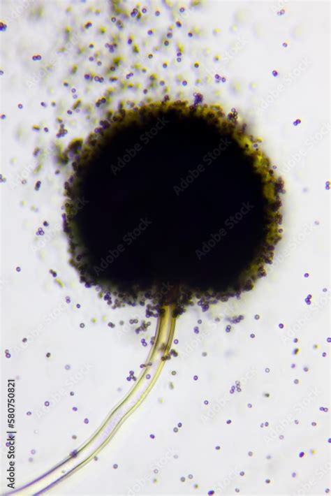 Microscopic View Of A Conidial Head Of Black Mold Aspergillus Niger With Spores Brightfield
