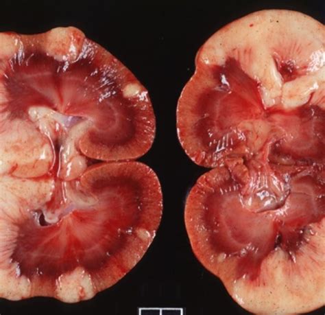 Hemolymphatic System 3 Flashcards Quizlet
