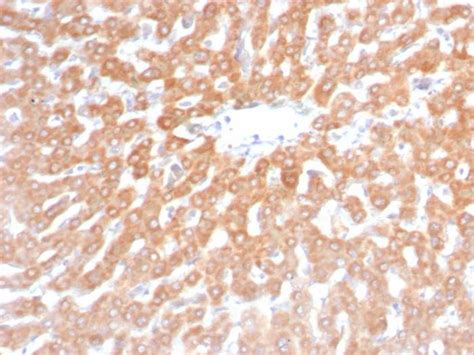 Sdhb Succinate Dehydrogenase B Pheochromocytoma Marker Recombinant Monoclonal Antibody