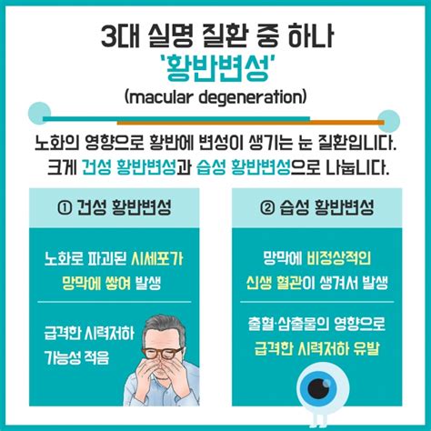 직선이 구부러져 보이나요 실명 질환 ‘황반변성 자가진단 And 예방법 힐팁