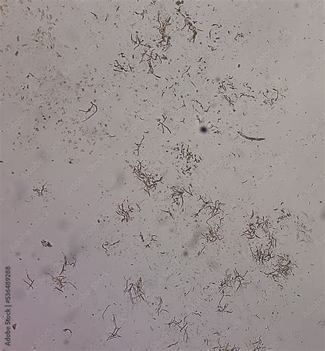 Microscopic Fungi Malassezia Furfur Showing Yeast Cells And Hyphae They Are Associated With