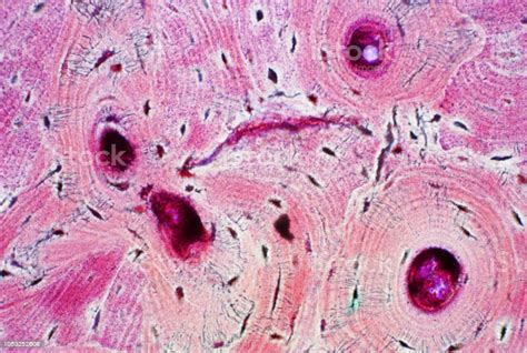 Anatomy Quiz Compact Bone Vs Spongy Bone Diagram Quizlet