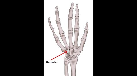 Anatomy Of Hamate Carpal Bone Hook Of Hamate Hamulus Overview