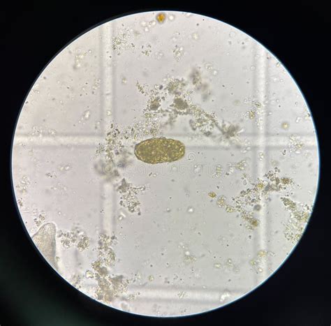 Human Parasite In Stool Examination Stock Image Image Of Anatomy
