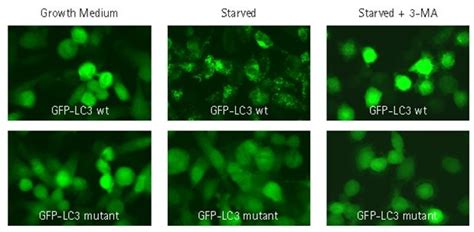 Fluorescent Live Cell Imaging Of Lc3 Mediated Autophagy Using