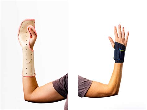 Splints And Orthoses Apricus Health