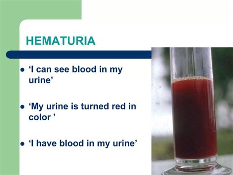 Approach To Hematuria General Pptx