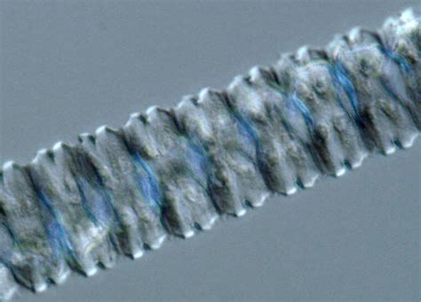 Zygnema Filamentous Algae Nikons Microscopyu