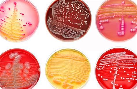 Ascp Boc On Linkedin Board Of Certification