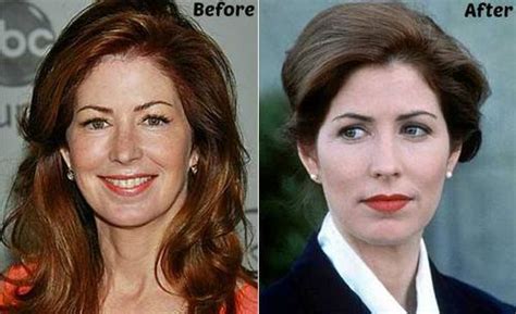 Omg Plastic Surgery Before And After Photos — Dana Delany Plastic