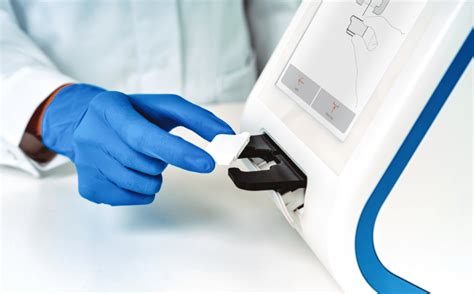 Abionics Test Diagnoses Sepsis 3 Days Before The Standards Methods Bioalps