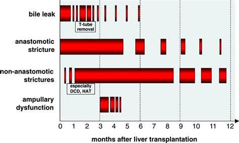 Biliary Complications In Pediatric Liver Transplantation Clinical Tree